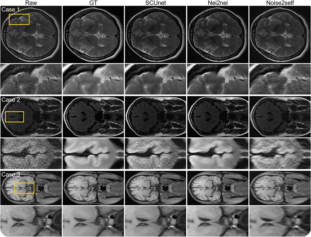 How Self-Supervised Learning Improves Image Denoising